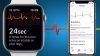 5 Free ECG Apps for Android & iOS | Free apps for Android and iOS