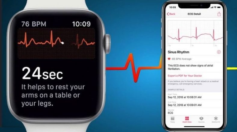 5 Free ECG Apps for Android & iOS | Free apps for Android and iOS
