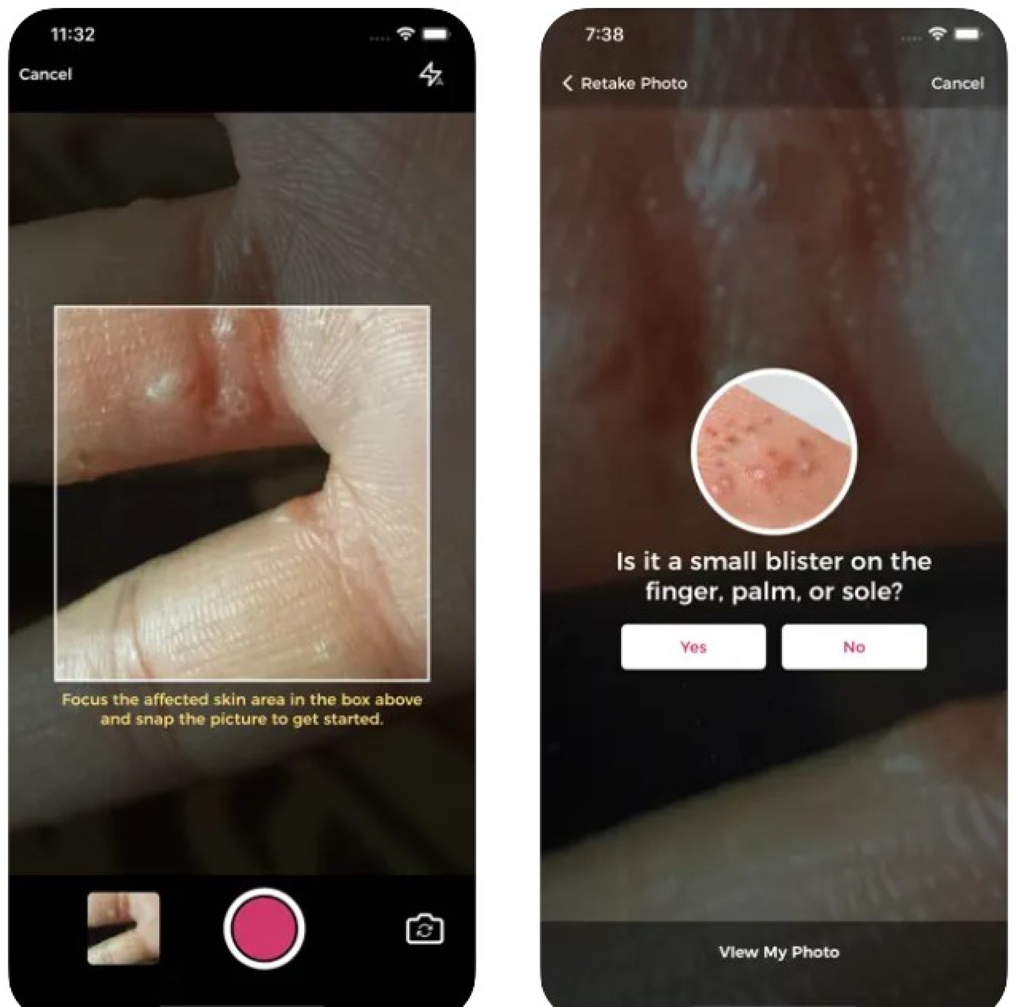 11 Best Dermatology Apps for 2025 (Android & iOS) | Freeappsforme ...