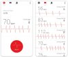 12 Best Heart Rate Monitor Apps for Android & iOS | Freeappsforme ...
