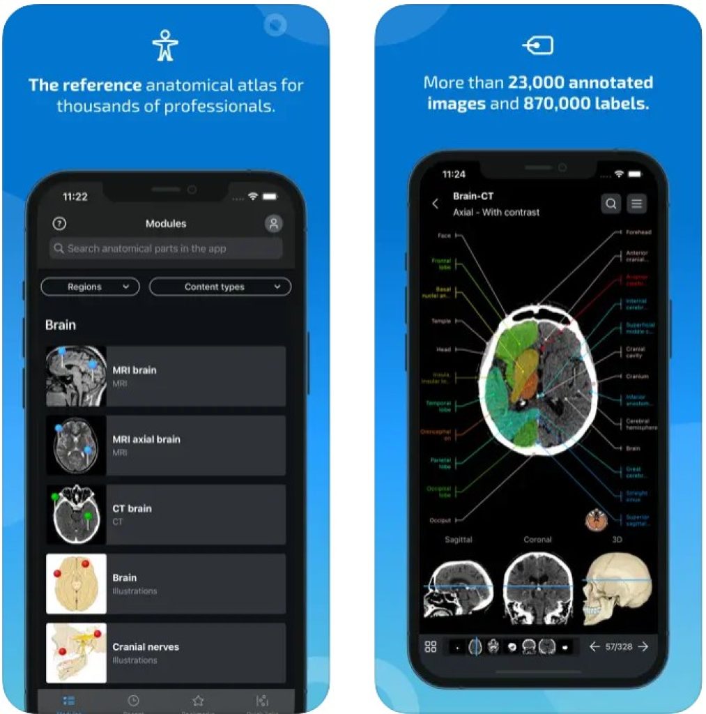 15 Free Radiology Apps for Android & iOS | Freeappsforme - Free apps ...