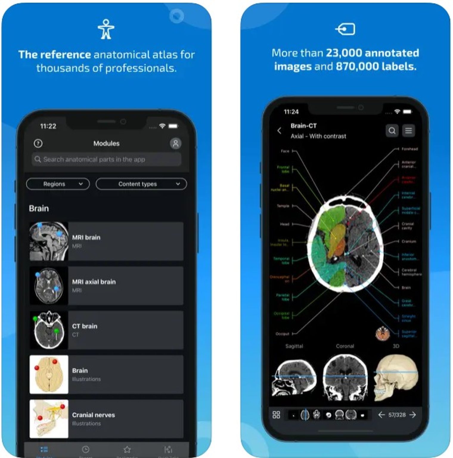15 Free Radiology Apps for Android & iOS | Freeappsforme - Free apps for Android and iOS