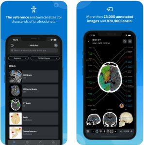 15 Free Radiology Apps for Android & iOS | Freeappsforme - Free apps ...