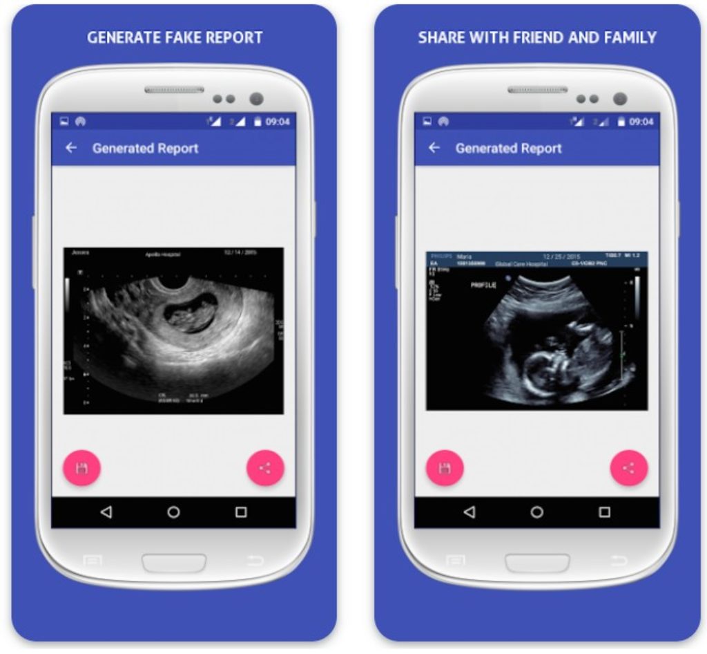 4 Free Fake Ultrasound Apps for Android & iOS | Freeappsforme - Free ...