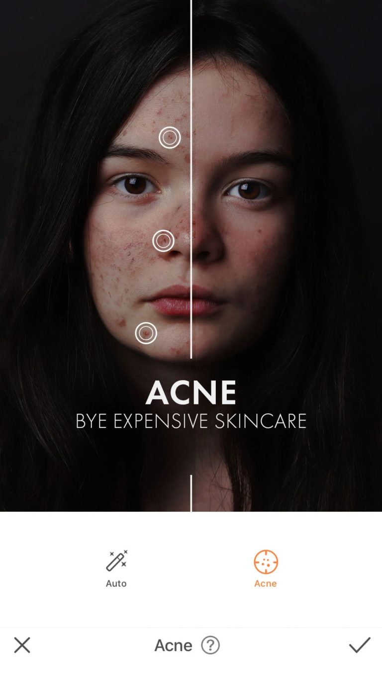 8 Free Teeth Editor Apps for Android & iOS | Freeappsforme - Free apps ...