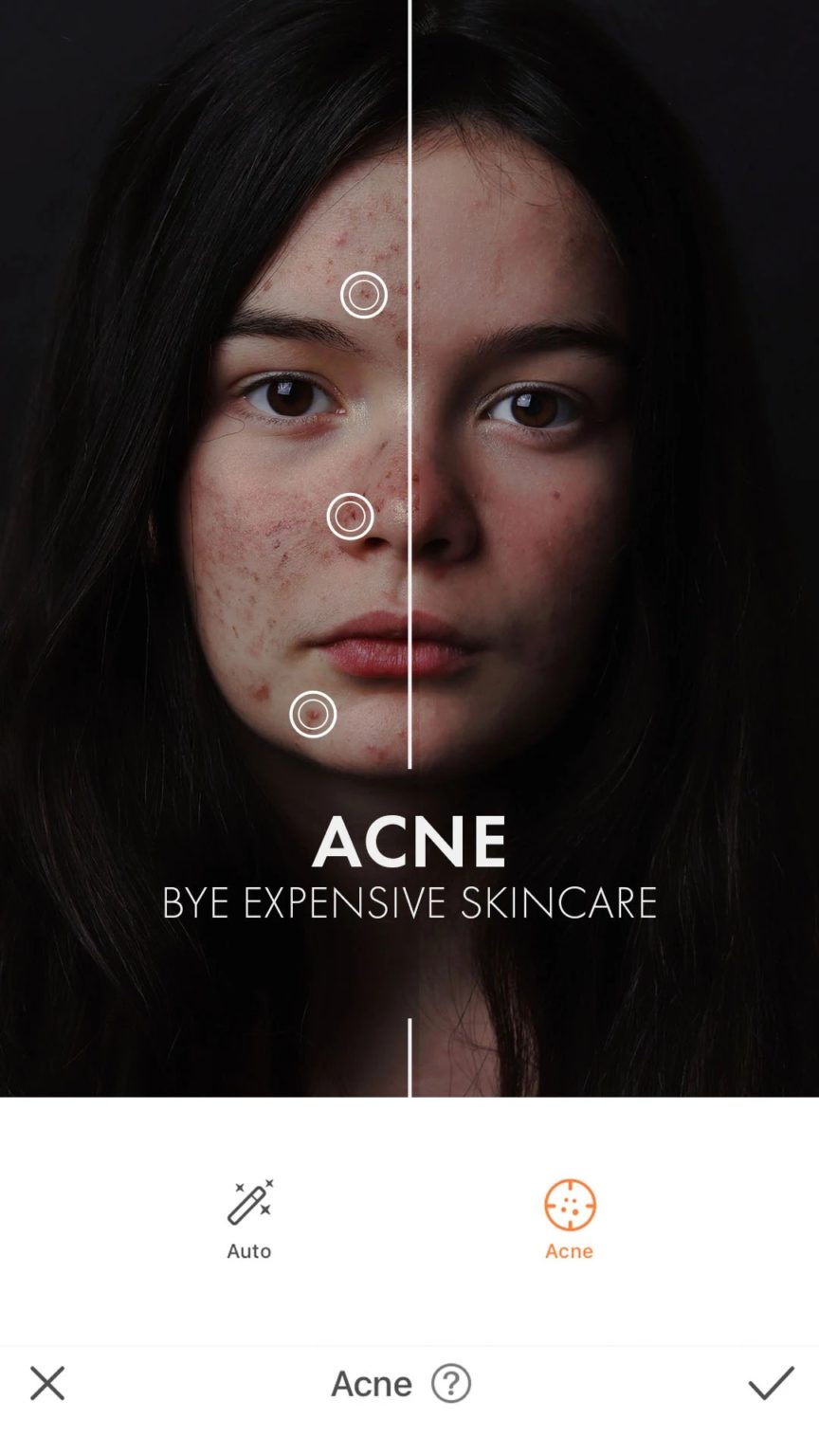 8 Free Teeth Editor Apps for Android & iOS | Freeappsforme - Free apps ...