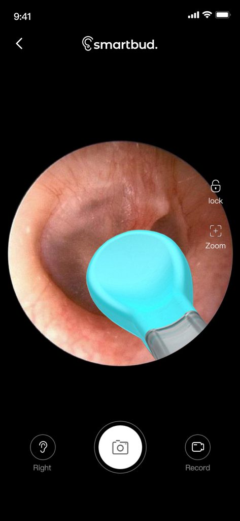 9 Best Otoscope Camera Apps in 2025 | Freeappsforme - Free apps for ...